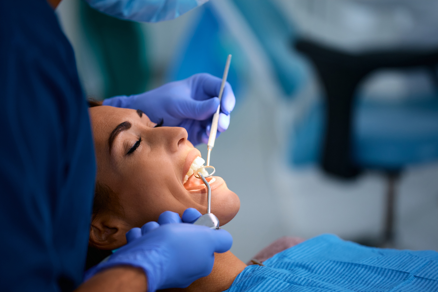 Dental Extractions: What You Need to Know Before, During, After